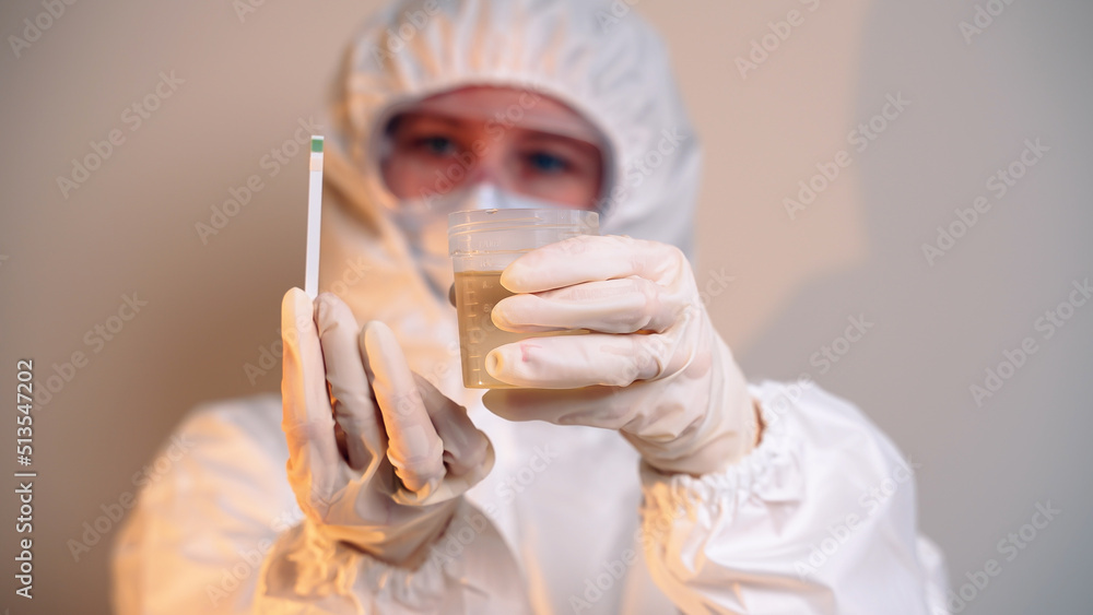 Medical laboratory diagnosing of ketonuria by using ketone screening ...