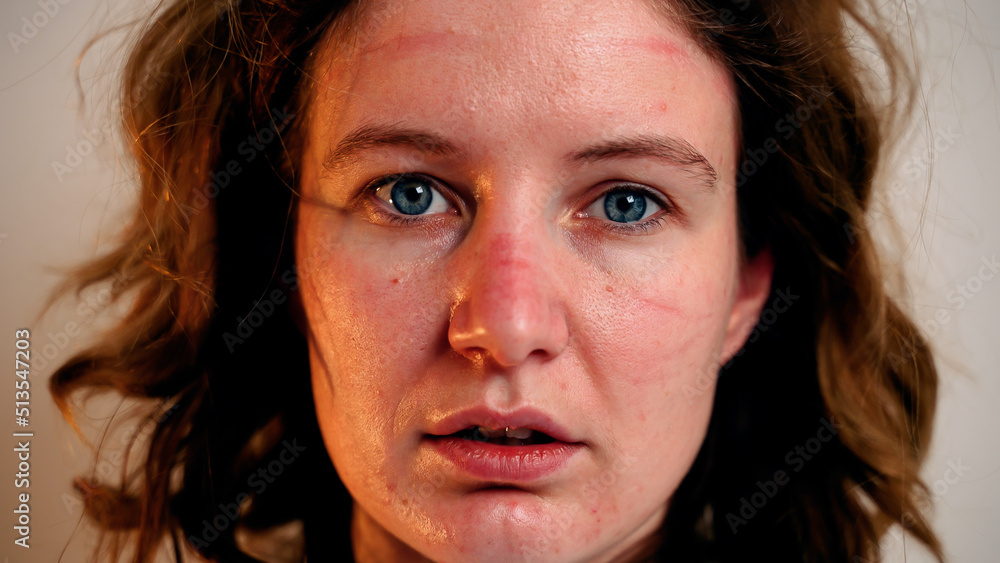 Female doctor during coronavirus pandemic covid-19 takes off glasses ...