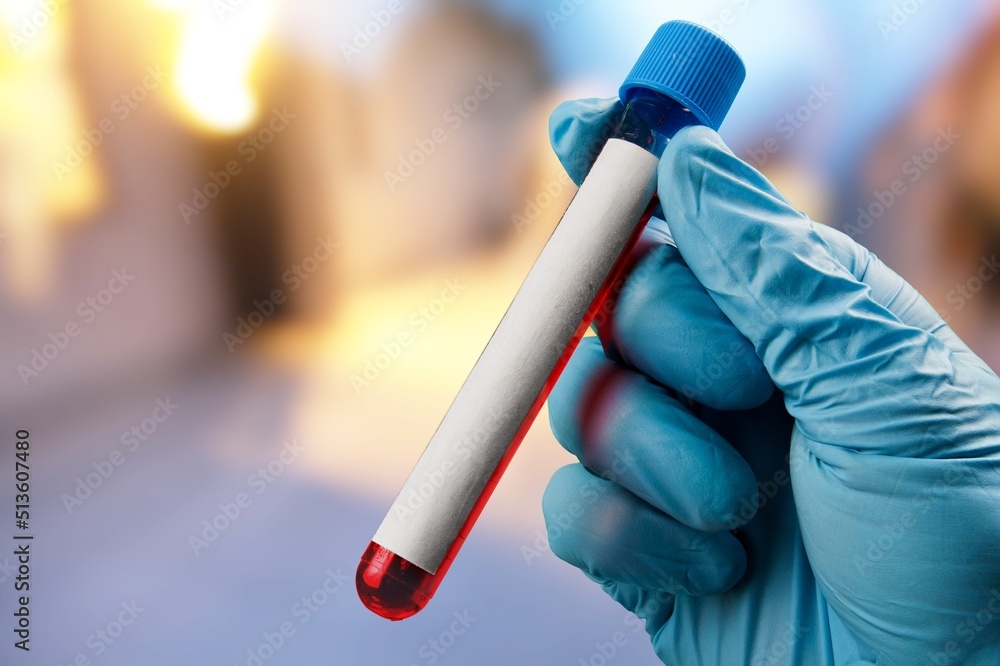 Iron Test Medical check up test tube with biological sample concept ...