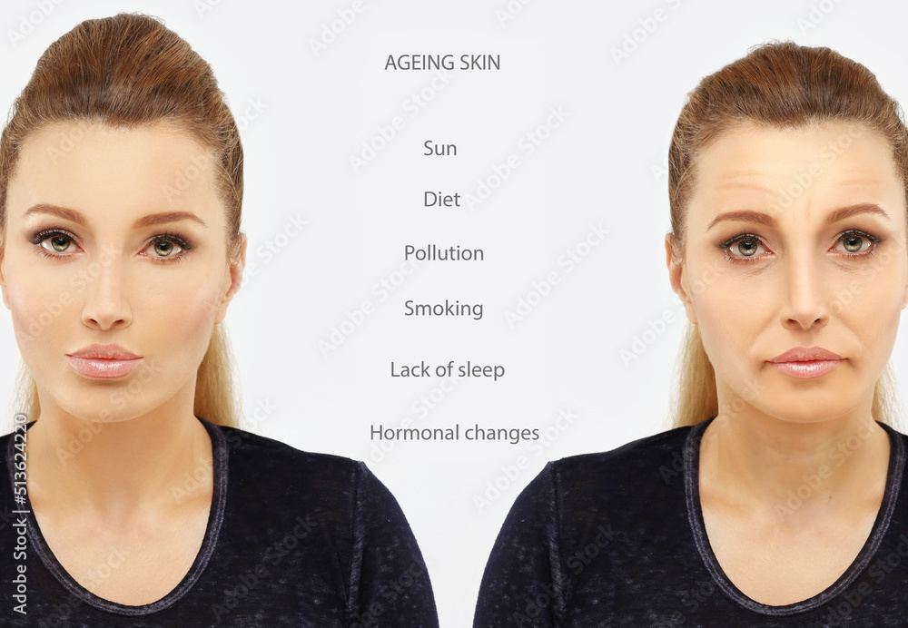 Ageing skin ,internal and external causes of skin aging, signs of skin ...