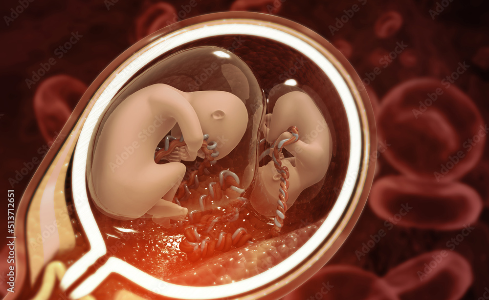 Twin fetus in the womb, overview of multiple pregnancy, 3d illustration ...