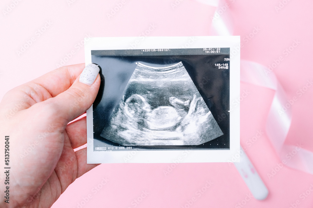 Ultrasound photo pregnancy baby. Woman hands holding ultrasound ...