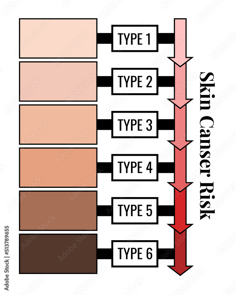 Fitzpatrick skin phototype scale with cancer risk dependence. Vertical ...