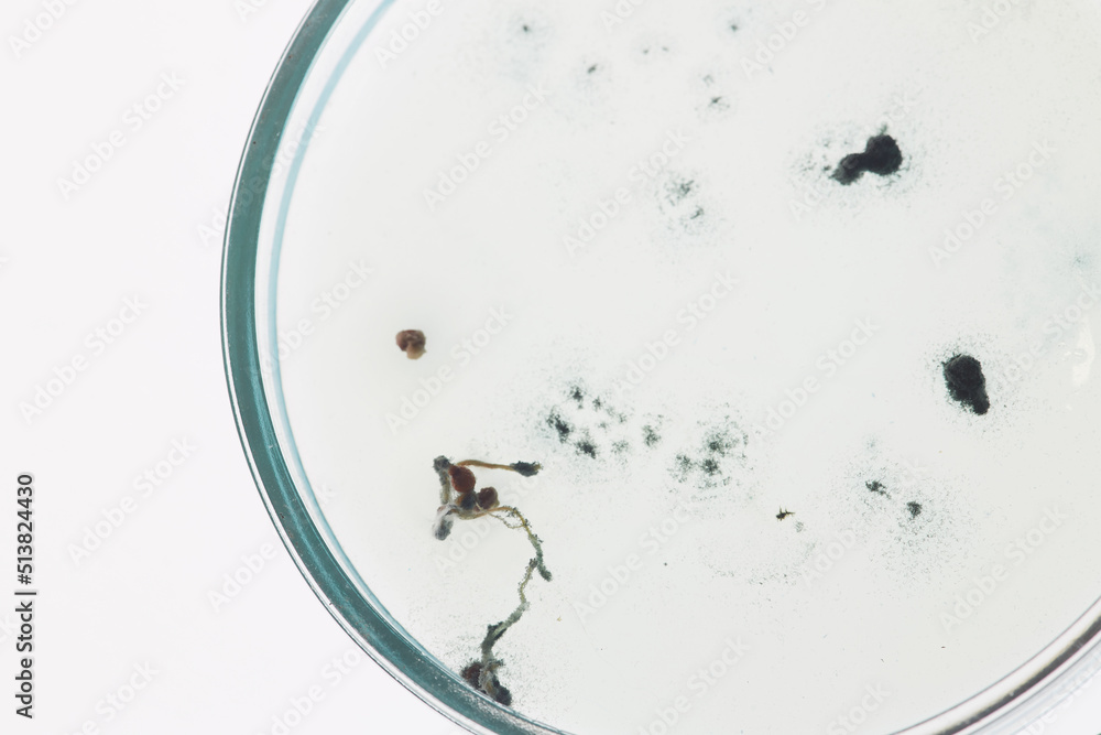 Background image of test sample of growing bacteria cells in petri dish ...