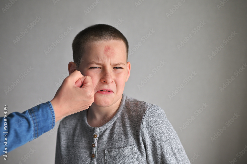 Fist of a parent near the face of a child with a bruise on his forehead ...