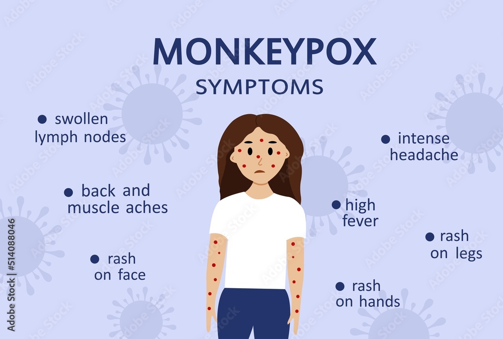 Monkeypox virus symptoms illustration with woman character. Monkeypox ...