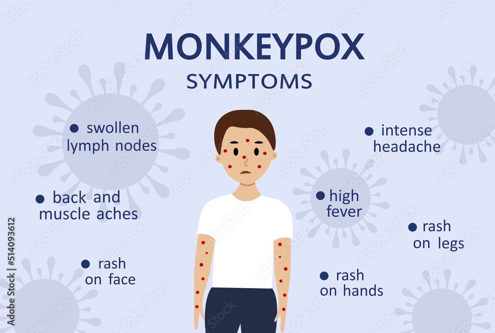 Monkeypox virus symptoms illustration with male character. Monkey pox ...