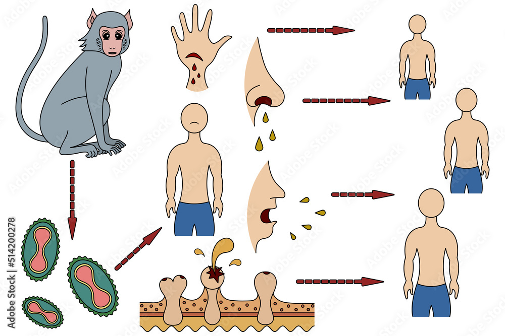 Monkeypox. The route of infection and the mechanism of transmission to ...