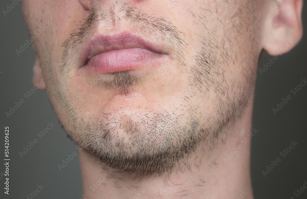 Short, sparse beard on mans face. Hair growth problems. Man with ...