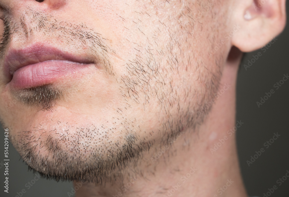 Short, sparse beard on mans face. Hair growth problems. Man with ...