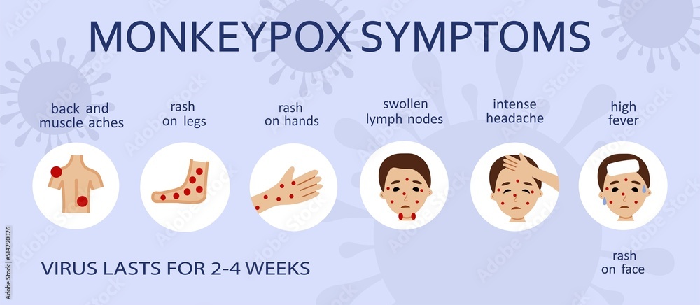 Monkeypox virus symptoms illustration with woman character. Monkeypox ...