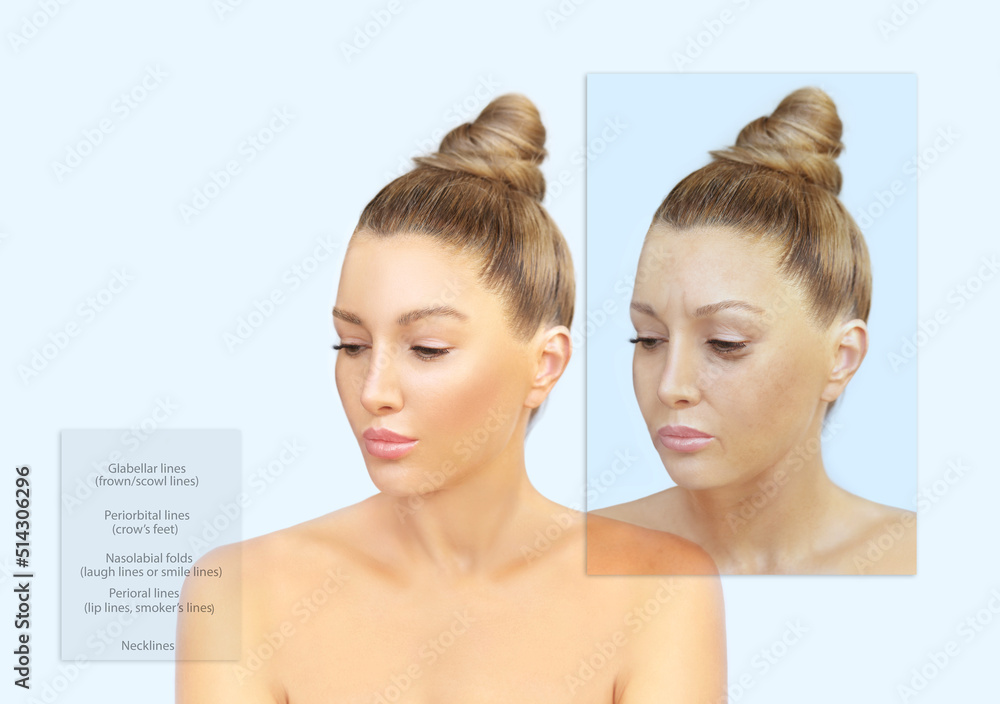 Ageing skin ,internal and external causes of skin aging, signs of skin ...