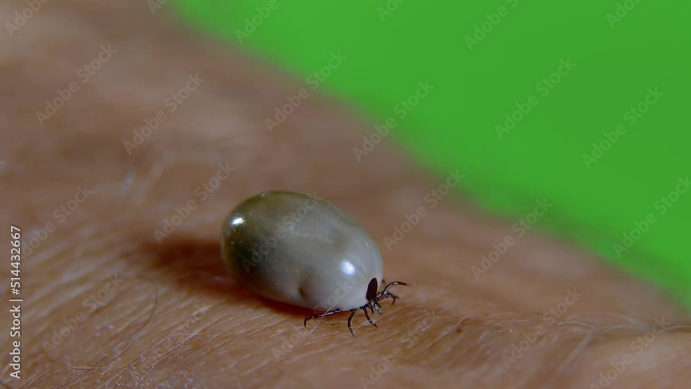 Tick infected with lime disease before biting a person. Parasites on ...
