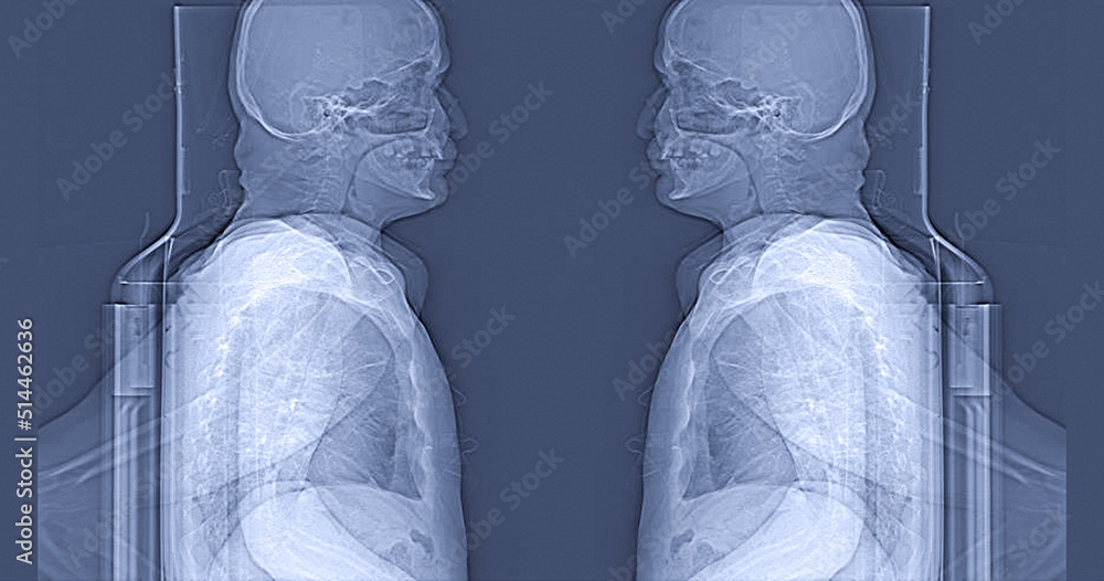 Human head on CT scan. Medical, science and education mri brain ...