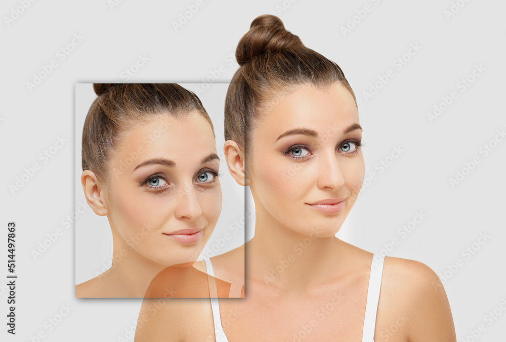 Ageing skin ,internal and external causes of skin aging, signs of skin ...