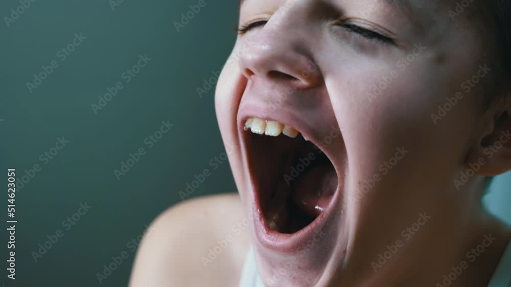 Close-up Face of a Yawning Sleepy Tired Child with a Wide-Open Mouth. A ...