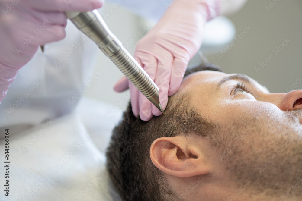 Doctor female dermatologist trichologist makes a procedure to stimulate ...