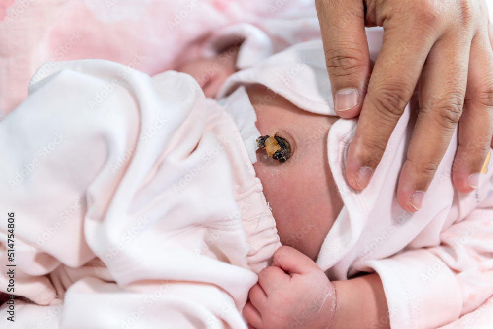 The mother's hand is placed on the body of a 7-day-old baby newborn, to ...
