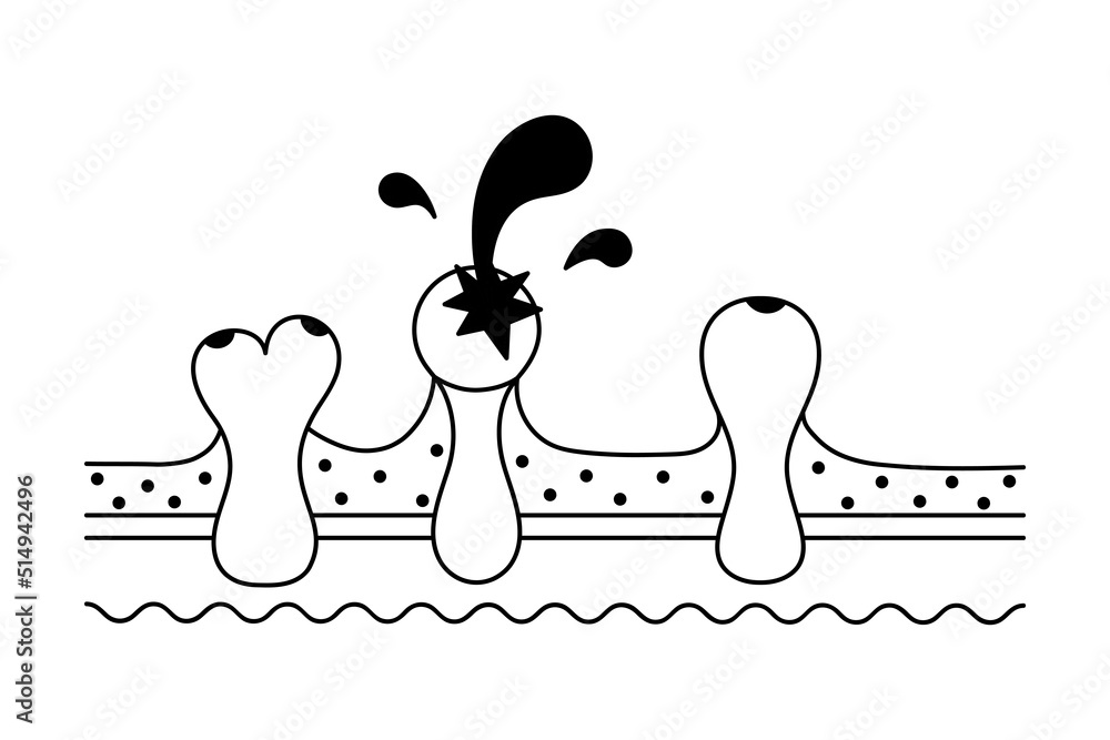 Pimples on the skin. The furuncle has matured and burst. Silhouettes of ...