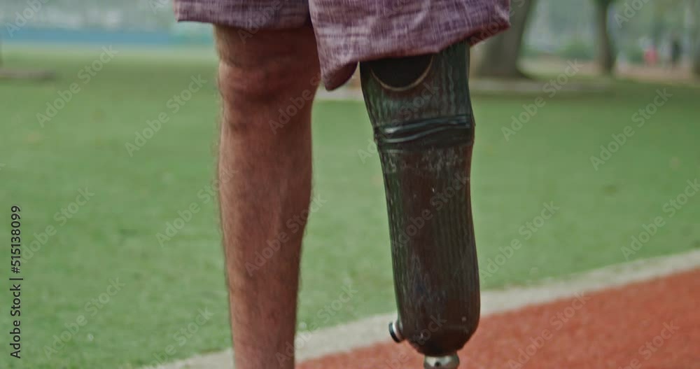 Revealing amputee athlete with prosthetic leg standing outside ...