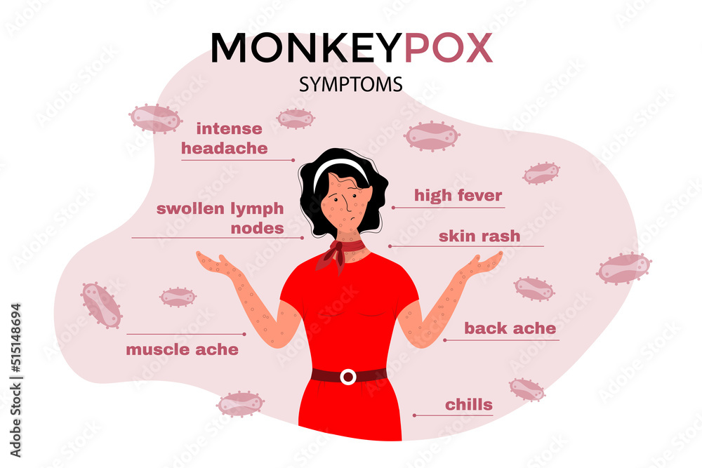 Monkey pox symptoms. girl with rash and list of symptoms. Headache ...