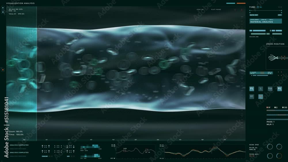 Program Interface Conducts Medical Scan Of Veins Concluding With Covid ...