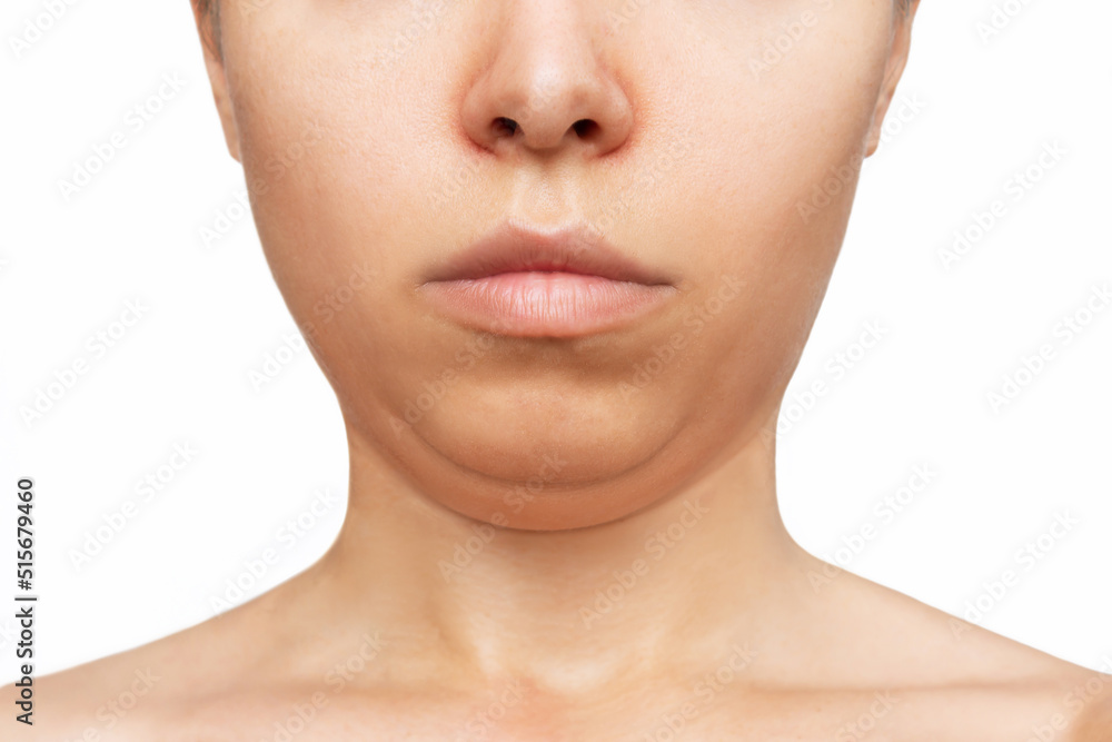 Cropped shot of a young woman's face with double chin isolated on a ...