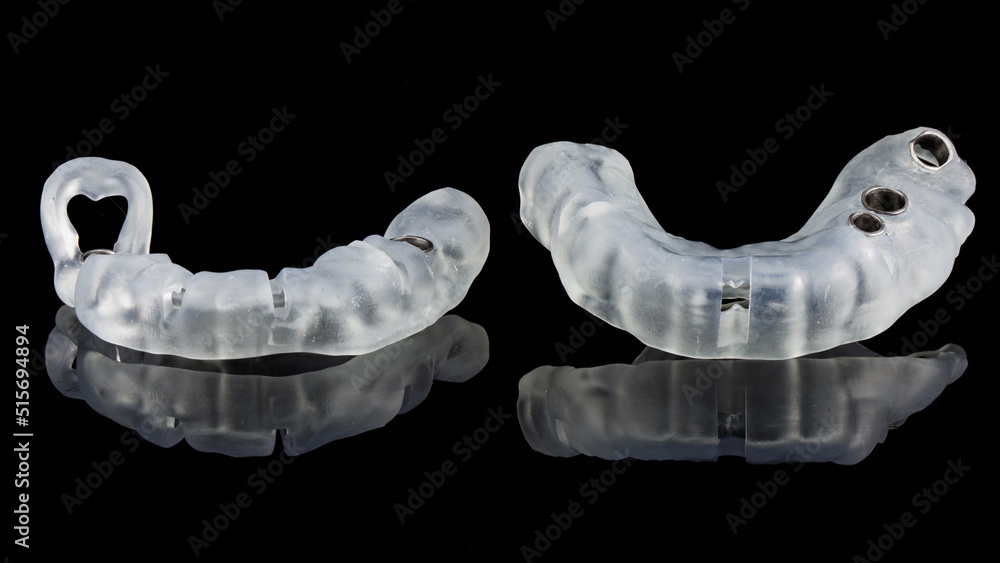 two high-quality dental templates for implantation in different areas ...