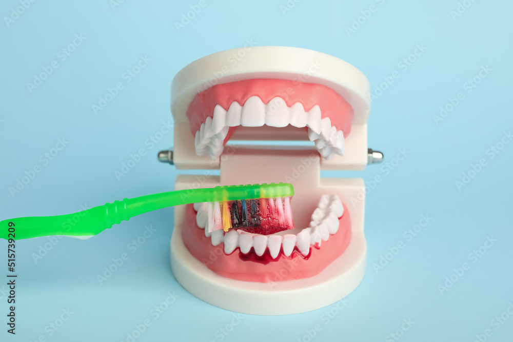 Jaw model and toothbrush with blood on light blue background. Gum ...
