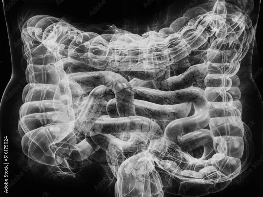X-ray of human abdominal medical anatomy MRI of cavity of abdominal ...