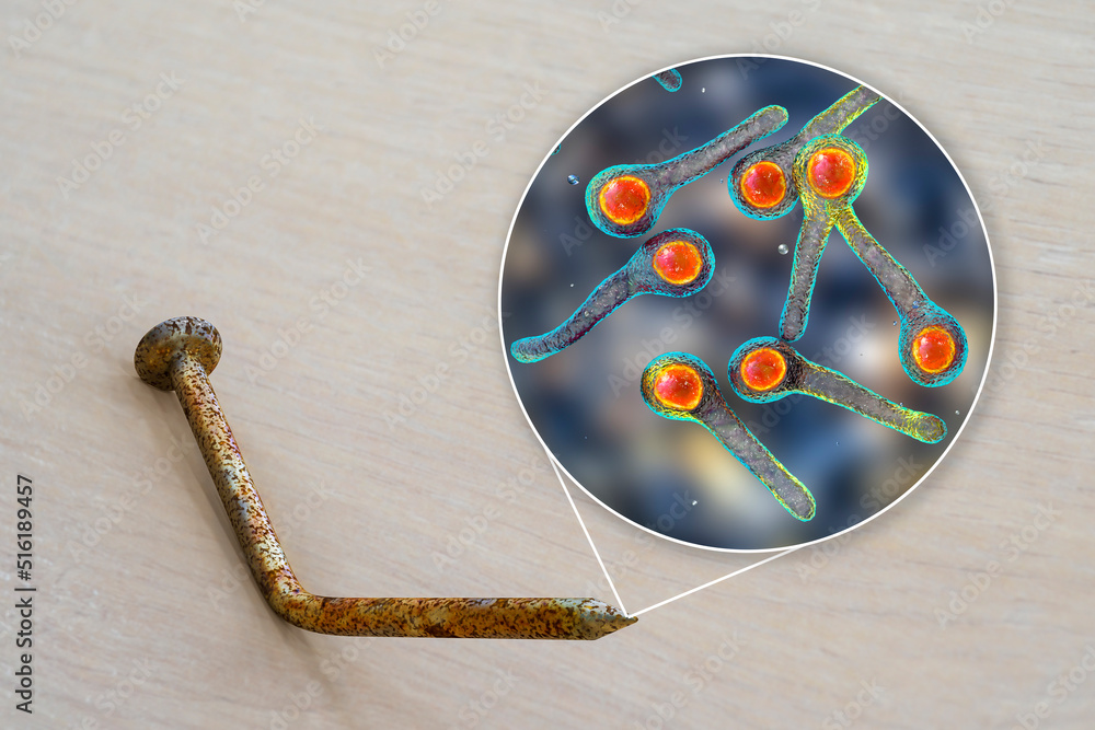 Tetanus. Bacteria Clostridium tetani and rusty metal nail Stock ...