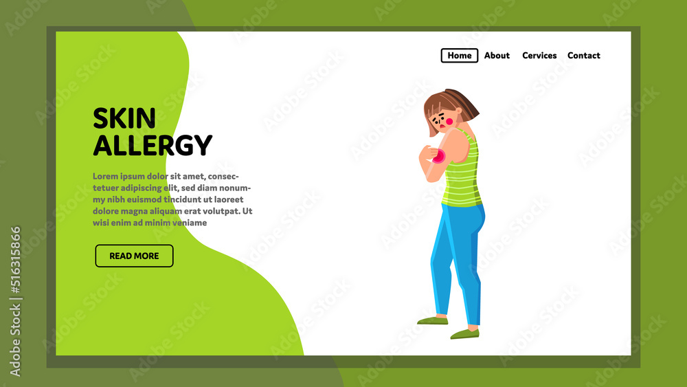 skin allergy vector. rash eczema, allergic scratch, dry itch skin ...