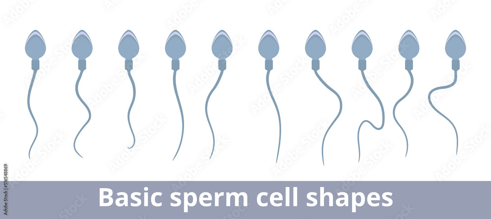 Basic sperm cell shapes. Visualization of a normal sperm cell with an ...