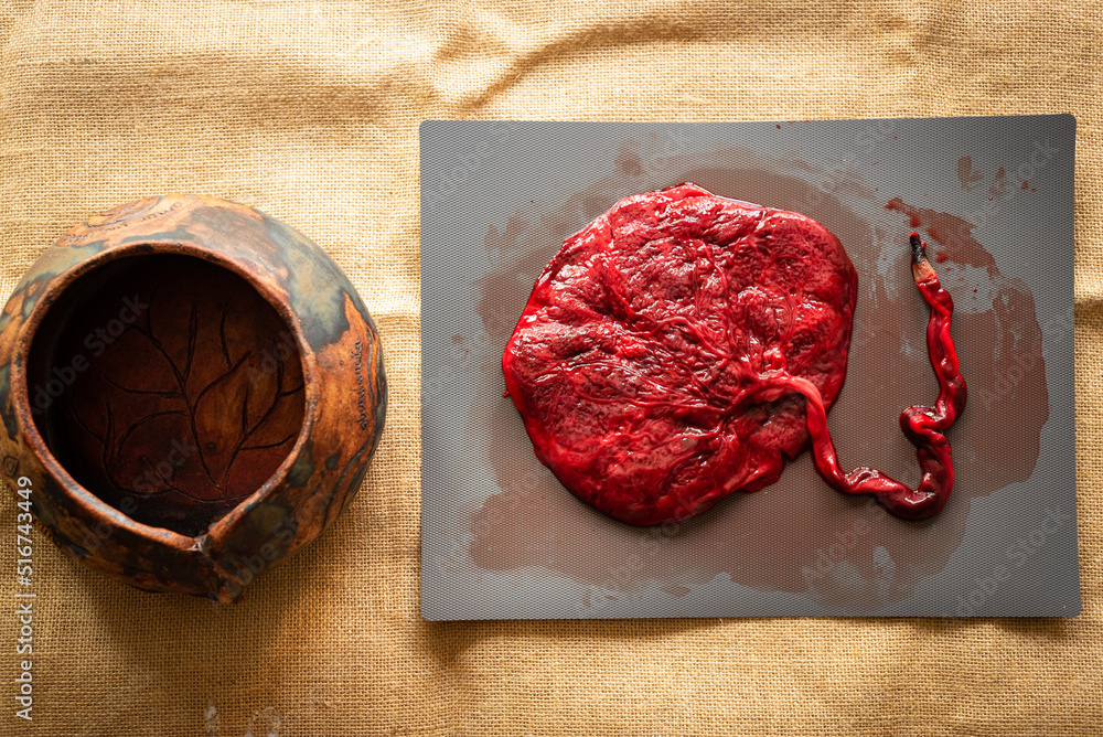 Foto de Top view of human placenta and umbilical cord of newborn baby ...