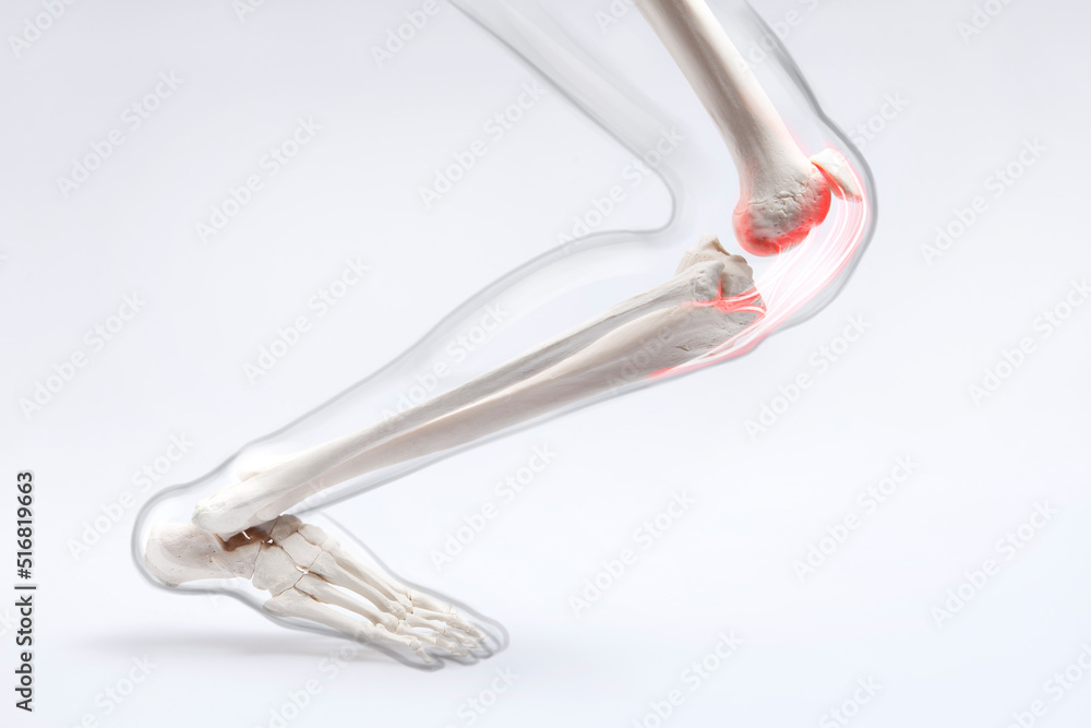 Poster Knee ligament and meniscus, human leg, medically accurate ...