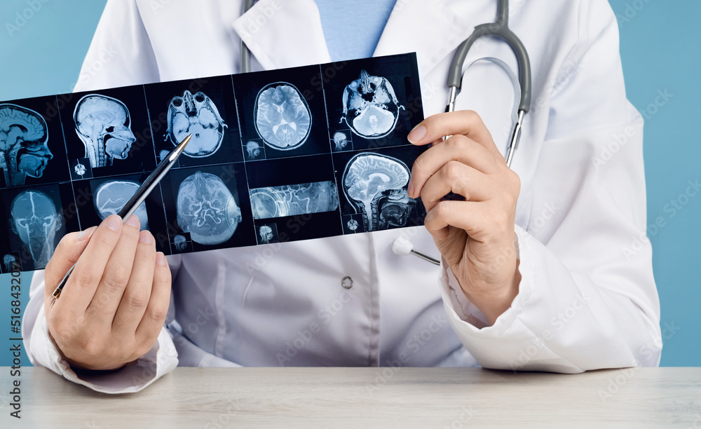 Female doctors hand pointing at x-ray or MRI medical imaging with a ...