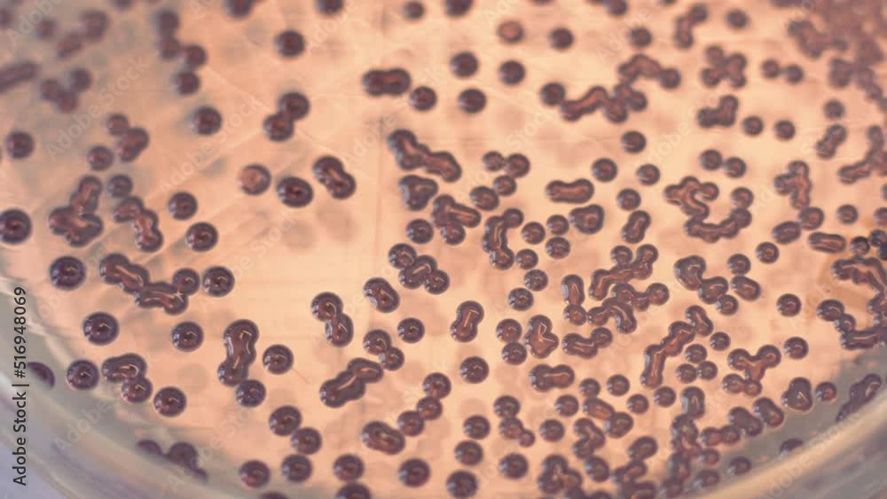 Vídeo do Stock: Macro View of Laboratory Bacteria and Germs in Petri ...