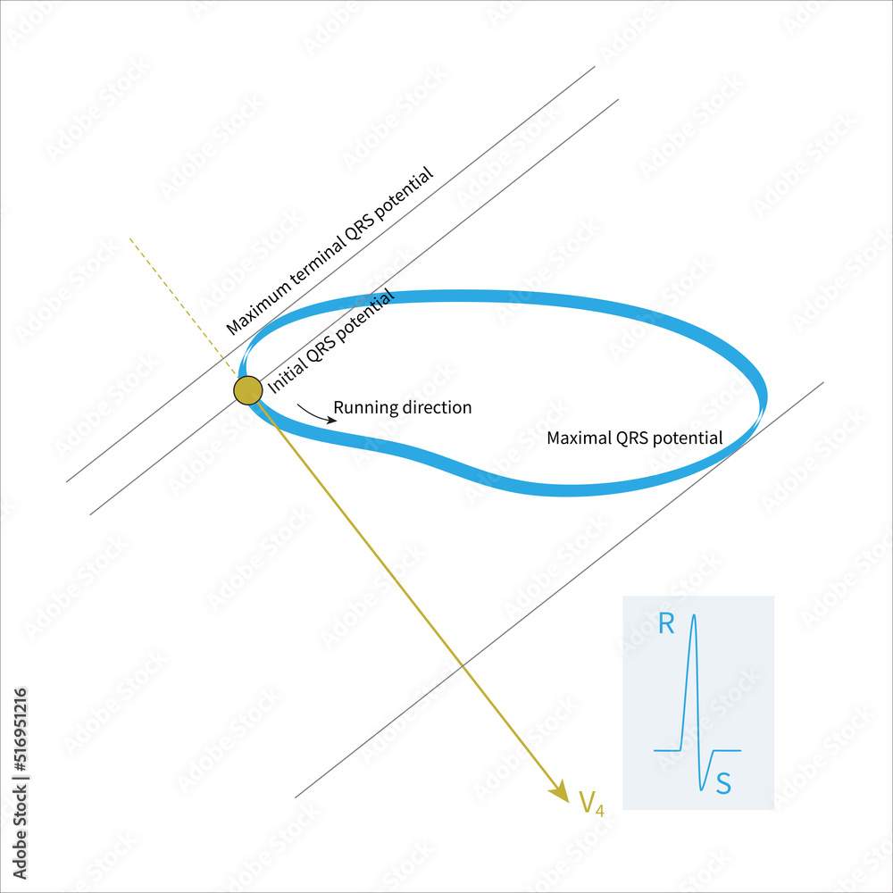 Plane QRS ring is ventricular depolarization ring, which can be divided ...