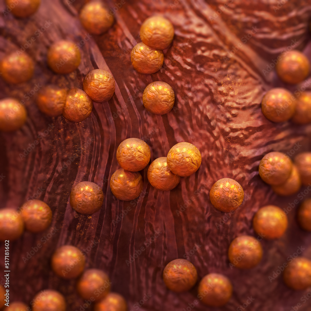 Medical background, Staphylococcus aureus, a type of spherical gram ...