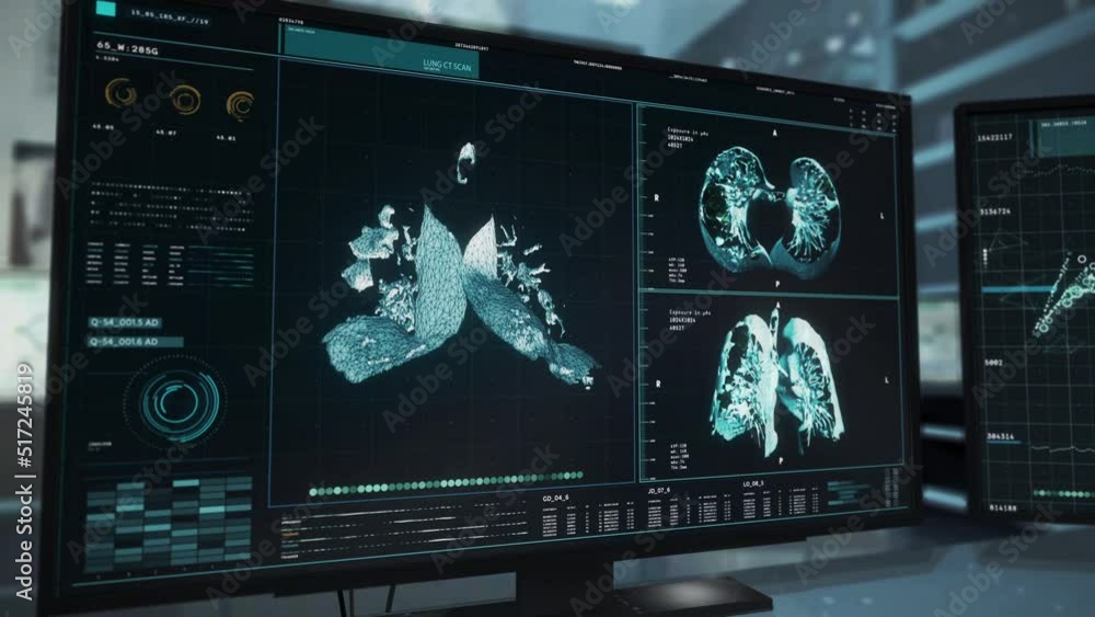 Biological examination system is analyzing the organ of the patient ...