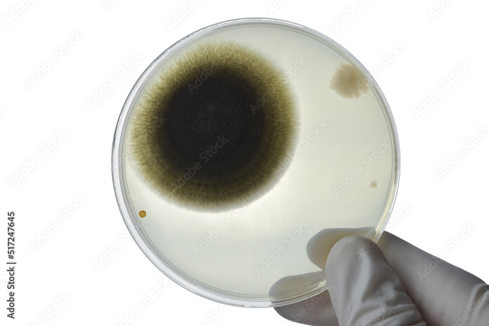 Hand with Petri dish or culture media with bacteria on white background ...