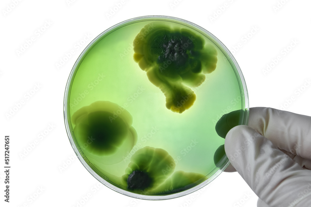 Hand with Petri dish or culture media with bacteria on white background ...
