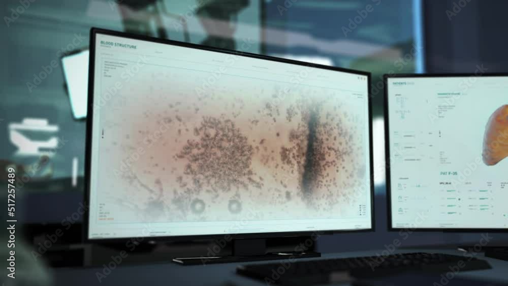 Blood Bacteria Structure Analysis In Microbiology Study. Patients Blood ...