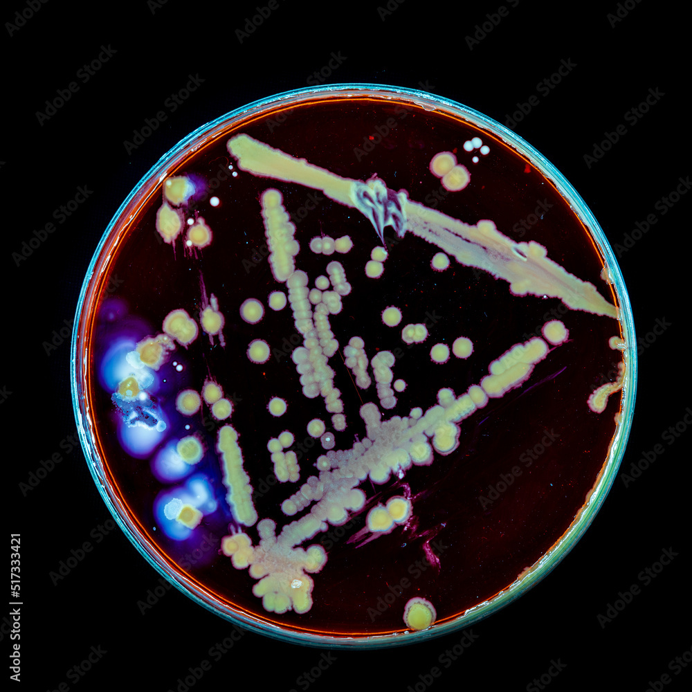 Samples of Petri dishes with a culture of microorganisms and fungi in the surface of agar ...