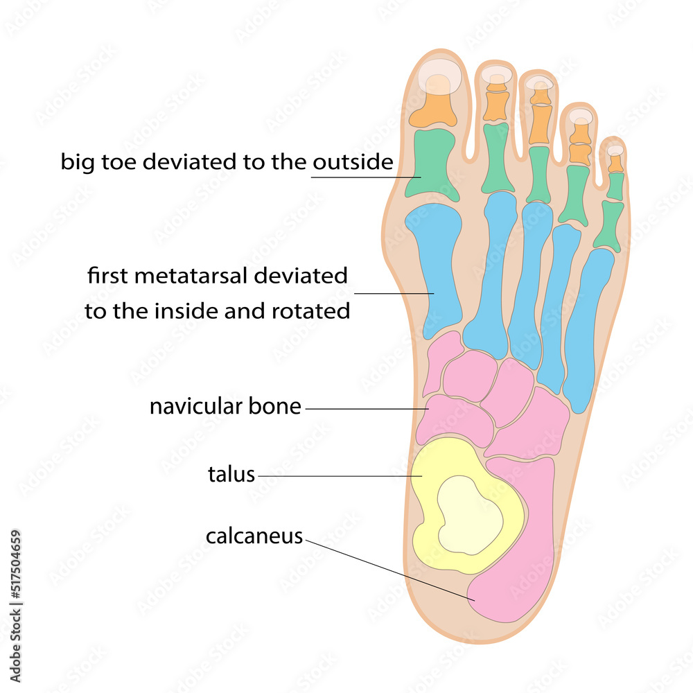 The structure of the human foot. Colorful symbols. Vector illustration ...