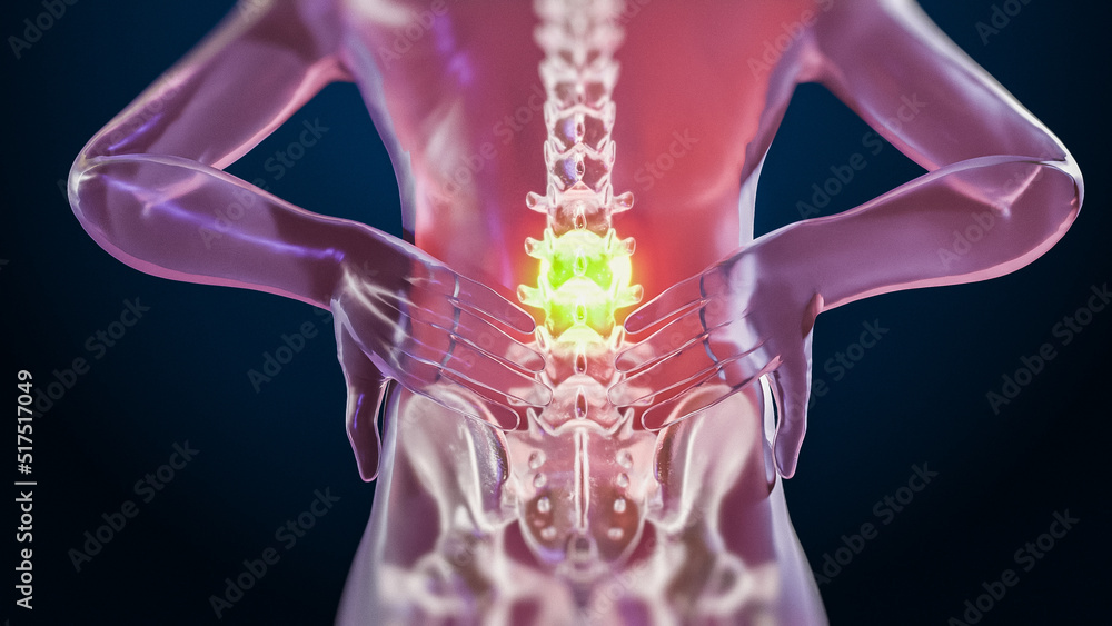 VFX Back Pain Virtual Reality Presentation Render. Digitally Generated ...