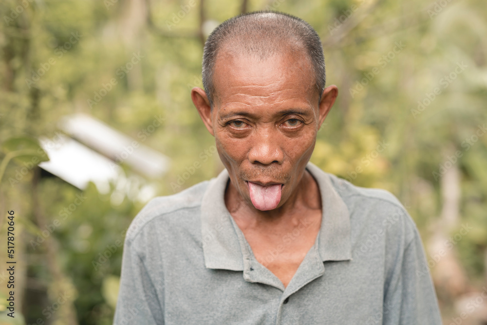 A Balding Filipino Man Teasing And Mocking Someone A Simpleton
