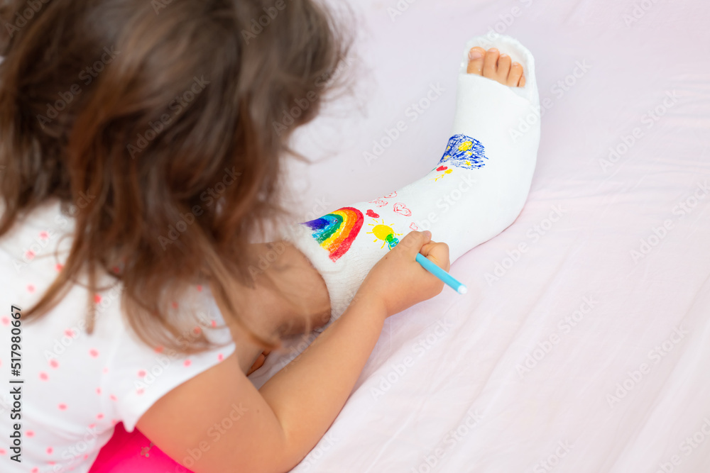 A unrecognizable little girl with a broken leg at home on the bed draws ...