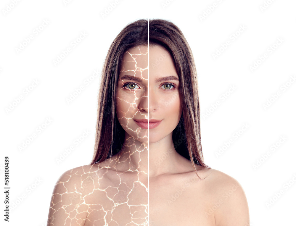 Collage with photos of woman having dry skin problem before and after ...