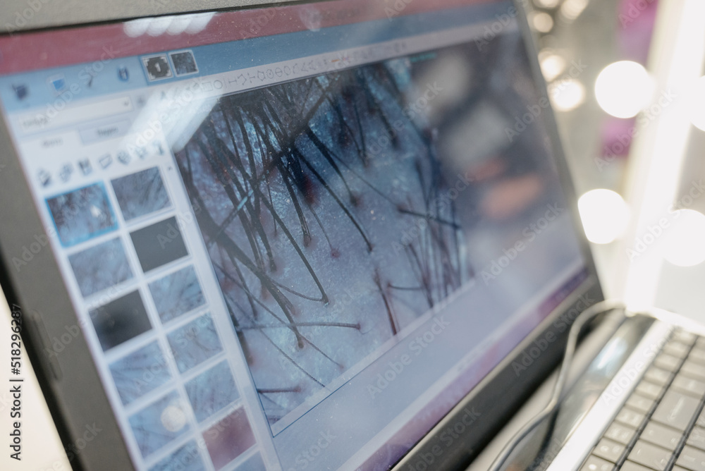 Diagnostic complex for microscopic examination of hair and skin of the ...